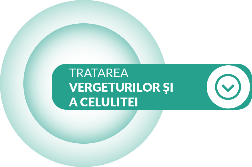 Tratarea vergeturilor si a celulitei - Swiss Clinics București
