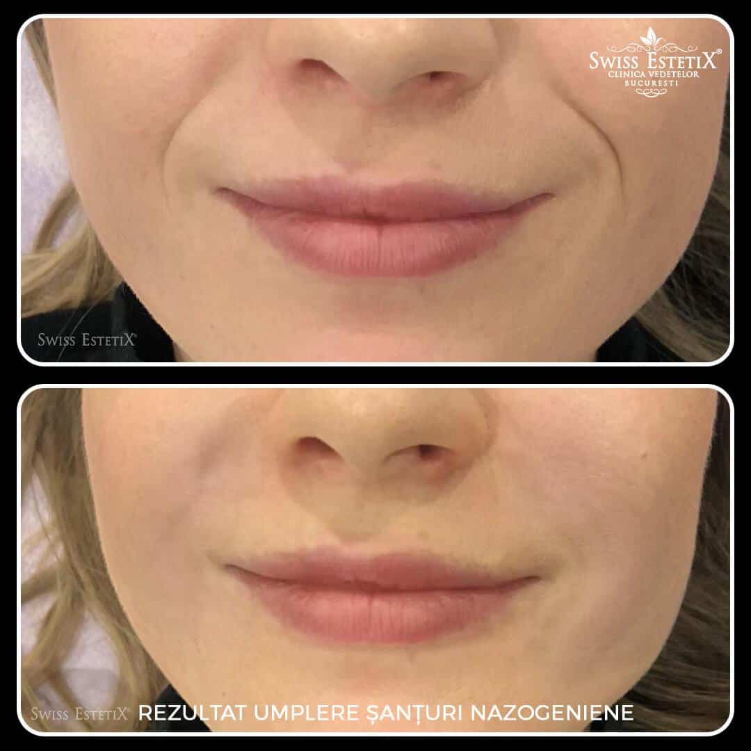 santuri 4 - Swiss Clinics București