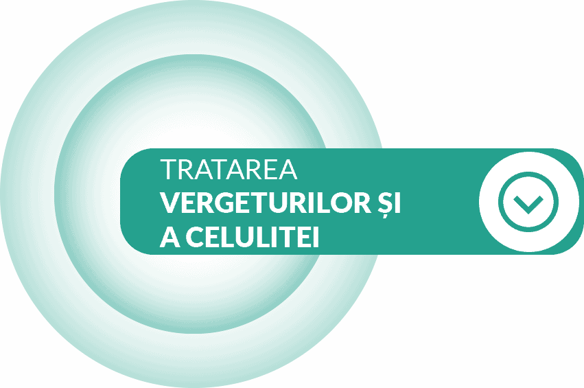 Tratarea vergeturilor si a celulitei - Swiss Clinics București